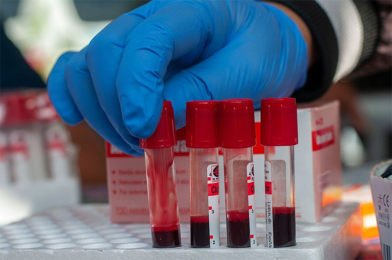 Indians and Egyptians involved in blood test fraud | arabtimes